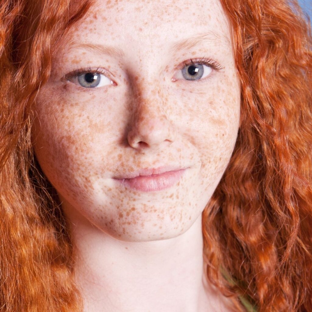 Freckles - Learn How to Sign